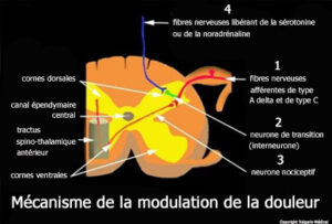 Douleur : physiologie, typologie - Symptômes, Causes et traitements
