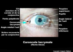 Caroncule lacrymale – Vulgaris-medical