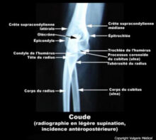 Coude (radiographie en légère supination) - Anatomie, photo et illustration