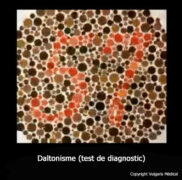 Daltonisme (test) – Vulgaris-medical