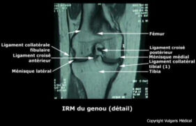 Genou (I.R.M. détails) - Anatomie, photo et illustration